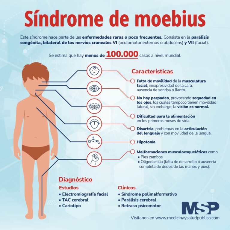 Sindrome de moebius - Psiquismo